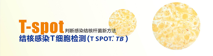 T-SPOT - 湖南省山水体检有限公司